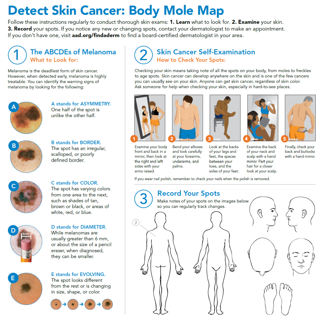 6 Surprising Places Skin Cancer Develops | Advanced Dermatology Care